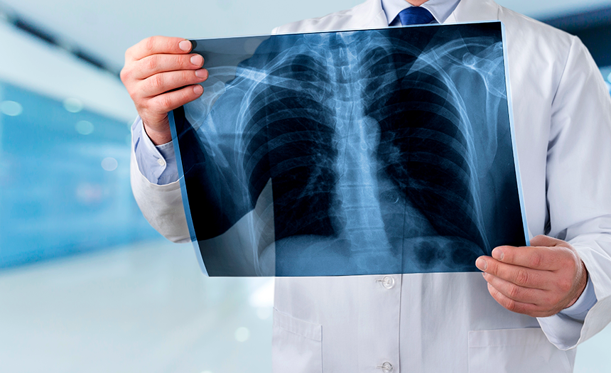 Cardiomegalia: los problemas de tener un corazón grande - Universal México